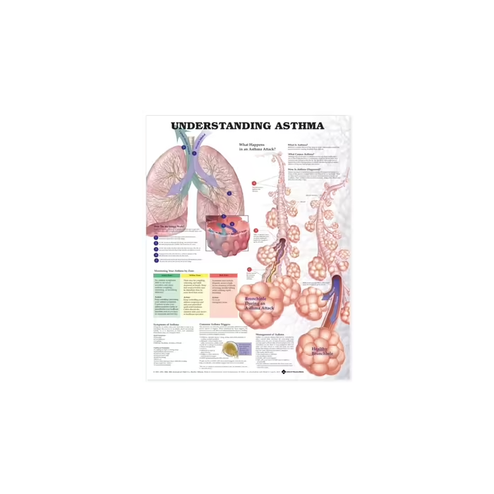 Unishop | Understanding Asthma Anatomical Chart Unishop | Understanding Asthma Anatomical Chart